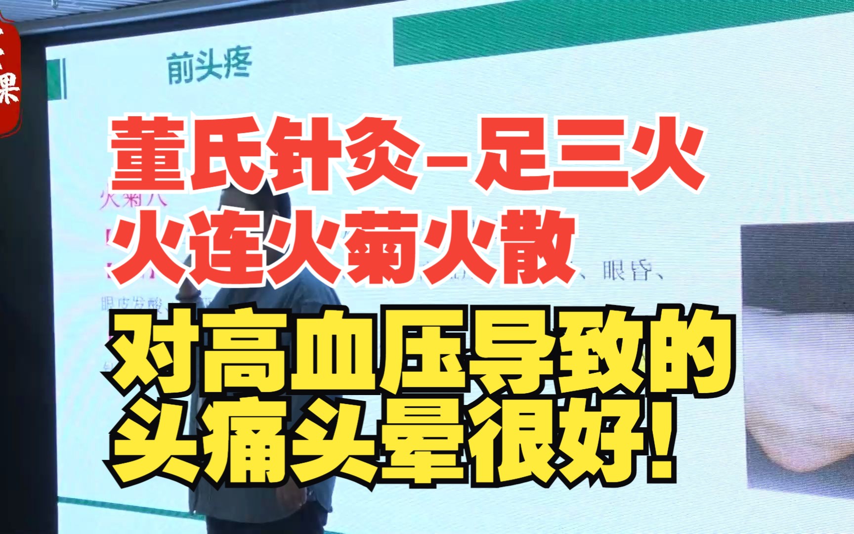 董氏针灸-足三火火连火菊火散,对高血压导致的头痛头晕很好!