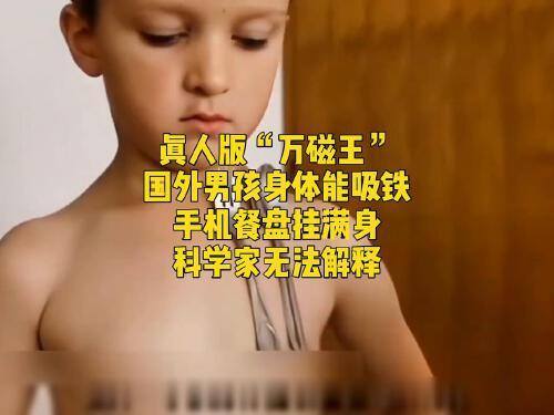 真人版"万磁王"?国外男孩身体能吸铁,手机餐盘挂满身,科学家无法解释!