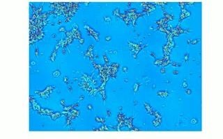 显微镜下胚胎干细胞转化成神经元细胞过程