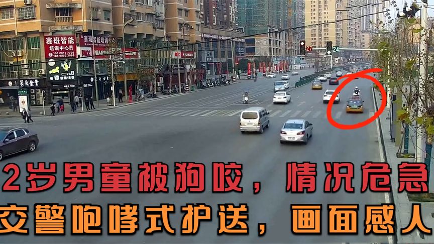 2岁男童被狗咬到脸部,急需送医,热心交警紧急开道护送,感人!