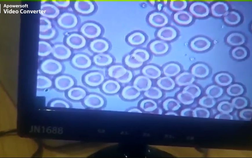 【科学实验】使用接地气床单40分钟的变化丨高倍显微镜下77岁...