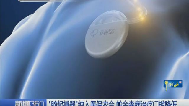 “脑起搏器”纳入医保农合 帕金森病治疗门槛降低