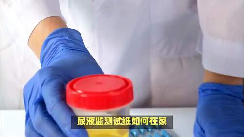 在家3分钟自测尿液健康!手把手教你用试纸测pH值和潜血