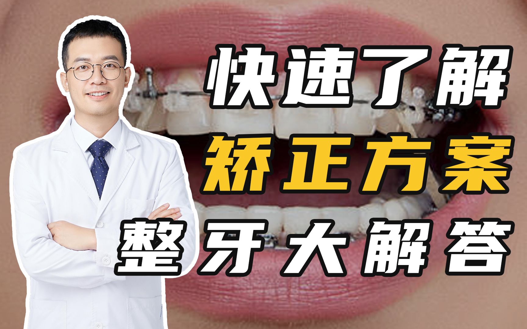 正畸医生是如何让你了解自己方案?