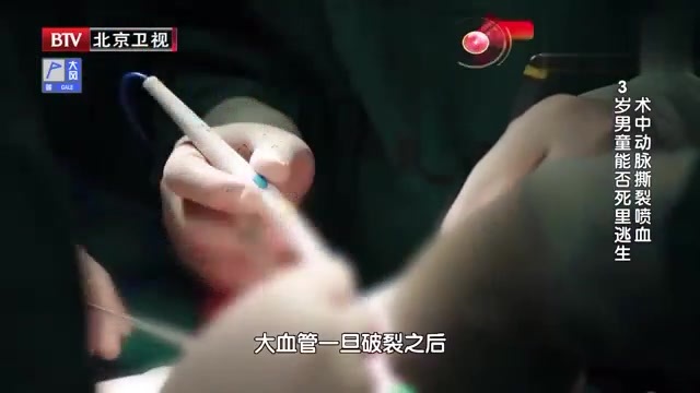 3岁男童术中动脉撕裂喷血,医生紧急打结止血,他能否死里逃生