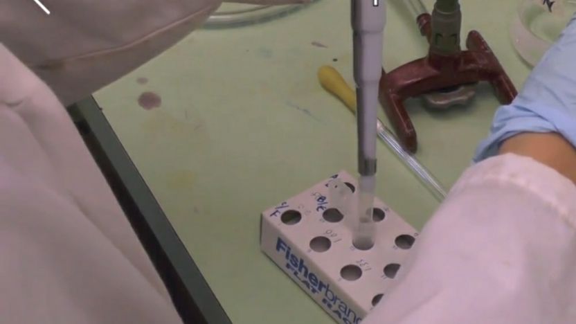 微生物基本实验操作,霉菌和酵母的计数