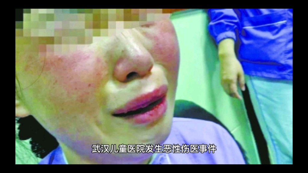 武汉儿童医院发生伤医事件,消化科主任被患者持刀砍伤。