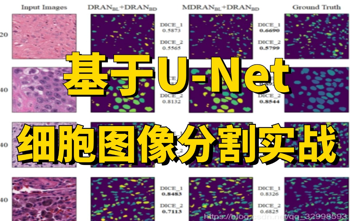 基于U-Net模型实现医学细胞图像分割,原理详解+项目实战,看完就能跑...