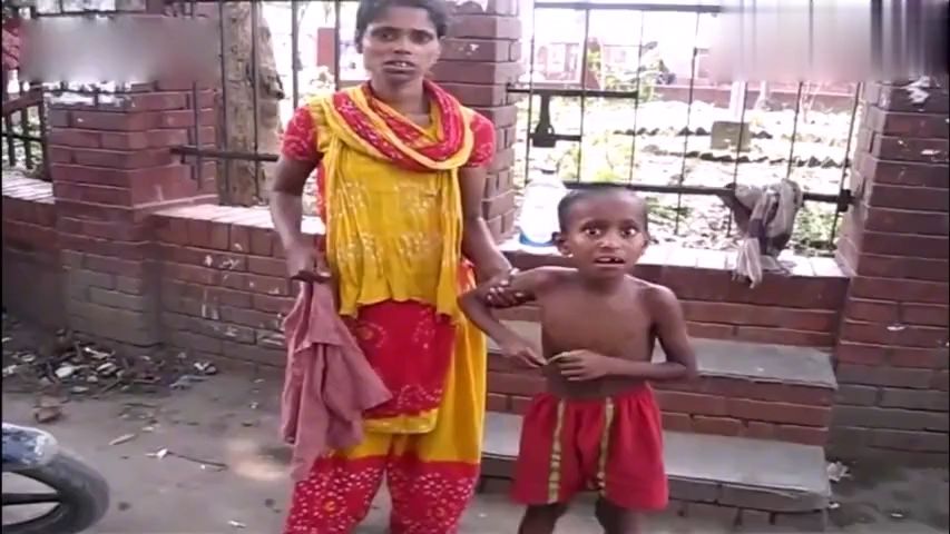 真实事例:印度小孩狂犬病发作,太可怜了