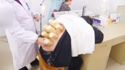 传统中医拔罐,让你舒心健爽