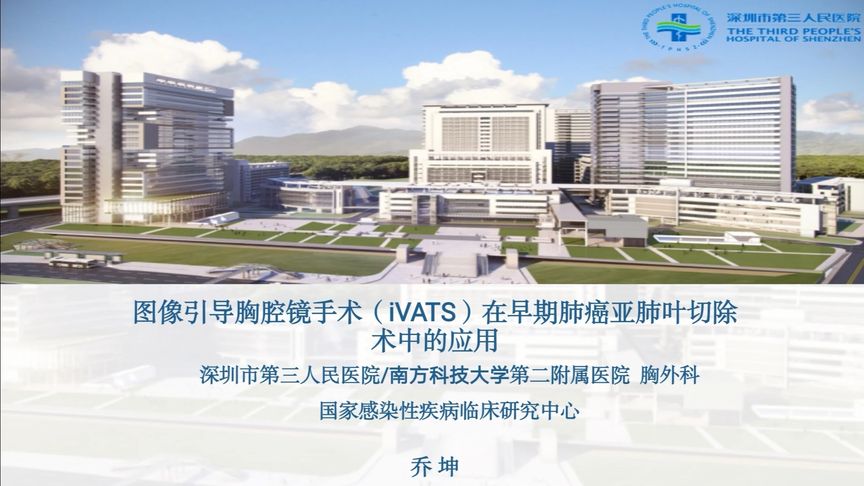 肺结节手术前还要去CT定位吗?那你就OUT了!