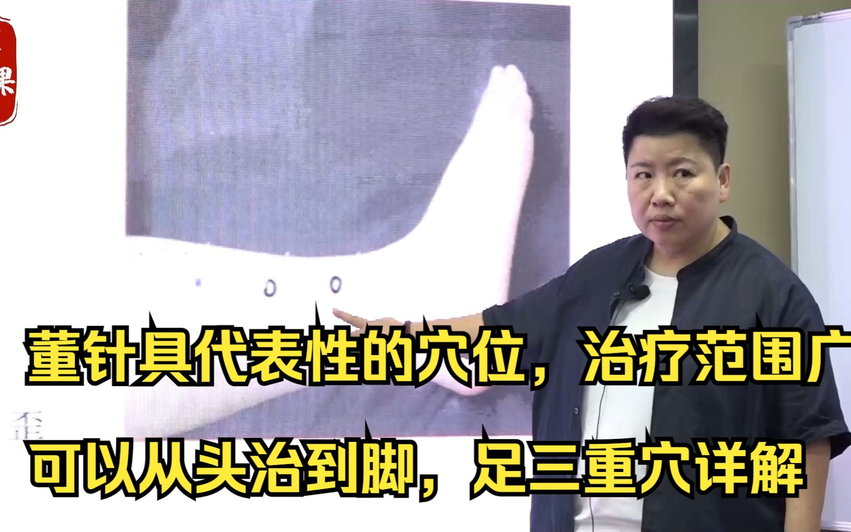 董针具代表性的穴位,治疗范围广,可以从头治到脚,足三重穴详解