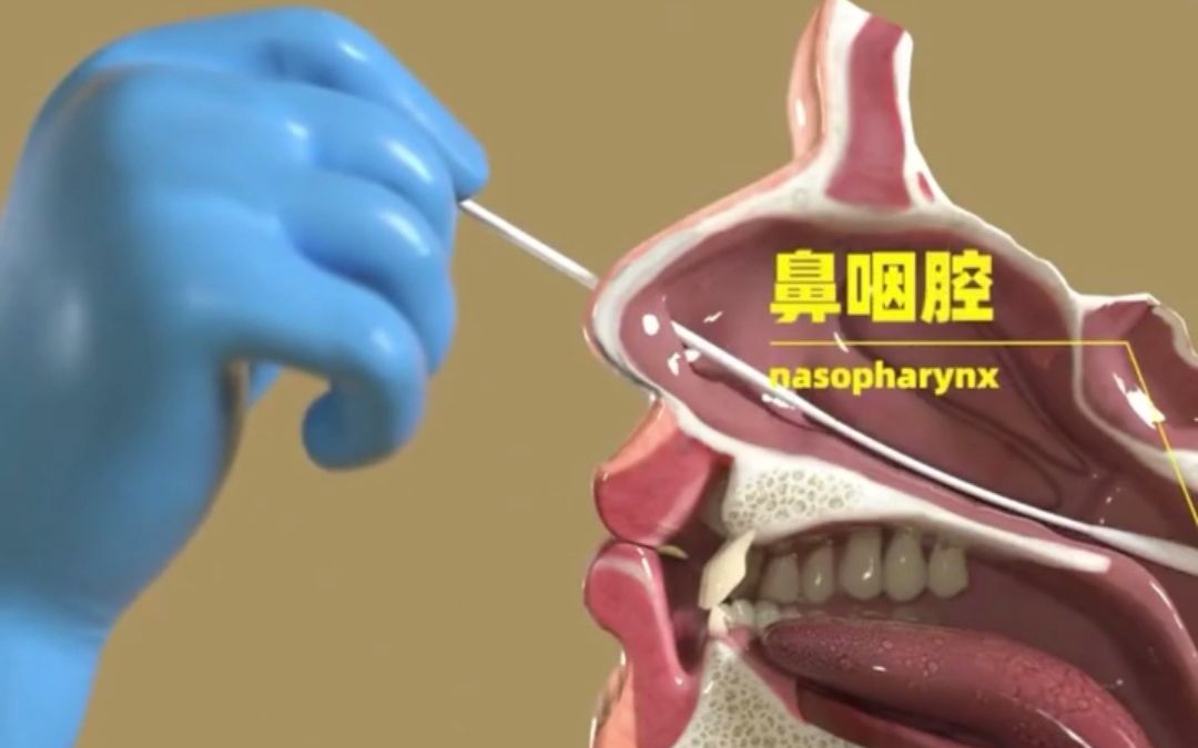 医学科普:鼻咽拭子3D动画演示