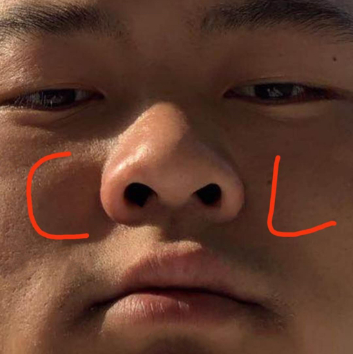 纯绿丸 