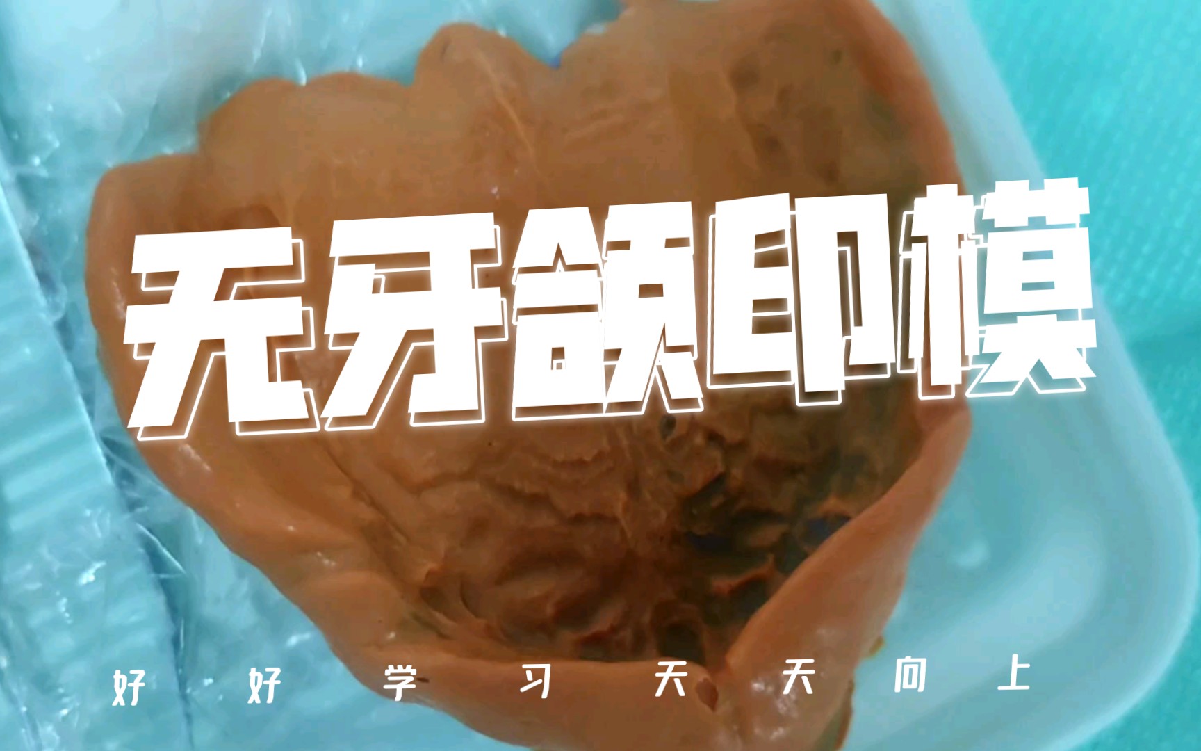 【口修】二次印模法制取无牙颌印模