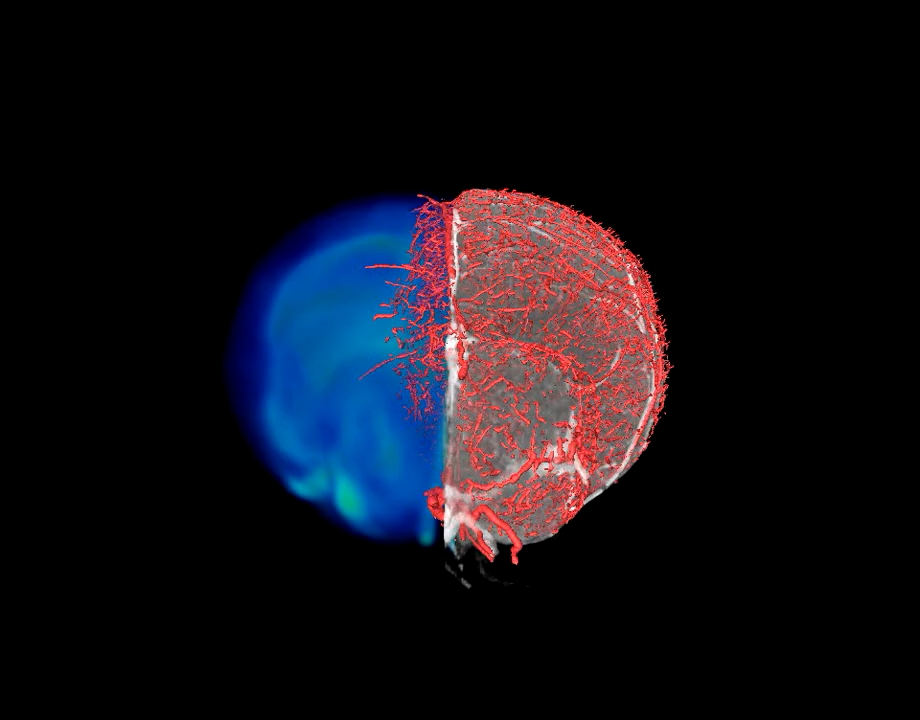 一种新方法可以创建任何器官中血管的虚拟 3D 模型。这一发现使得...