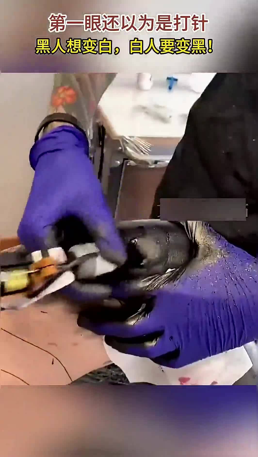 第一次见用输液器纹身,是我太孤陋寡闻