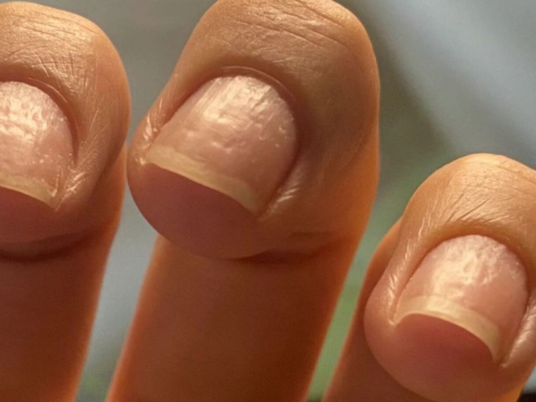 我们的手指甲上,有很多的细菌,需要我们时刻注意
