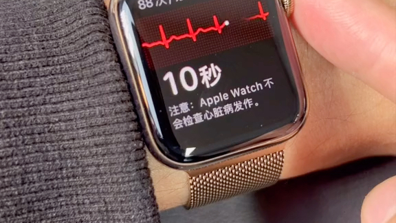 Apple Watch检测心电图心率的原理,原来这么小的手表里有这么多东西
