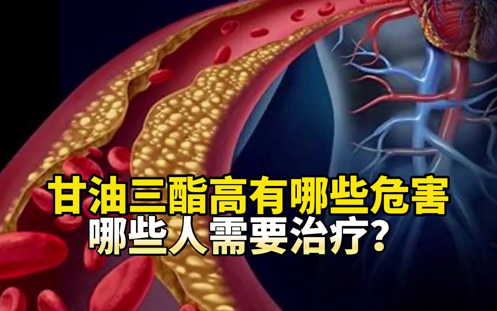 甘油三酯高有多大危害?哪些人需要吃药?给您最佳治疗方案