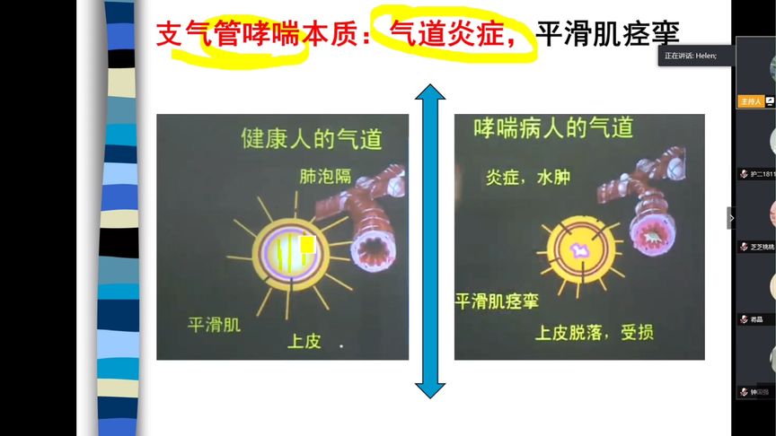 支气管哮喘定义及临床表现