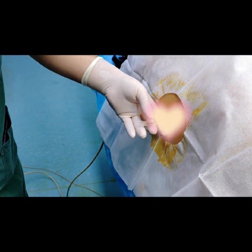 麻醉的效果影响整个手术过程,做手术前一定要积极地配合麻醉师哦