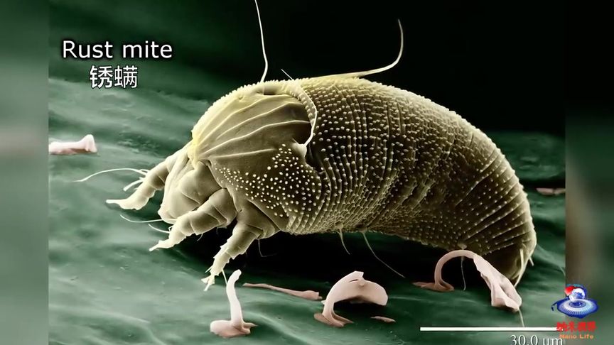 50幅用扫描电子显微镜拍摄的惊人图片,原来可怕的病毒长这么漂亮