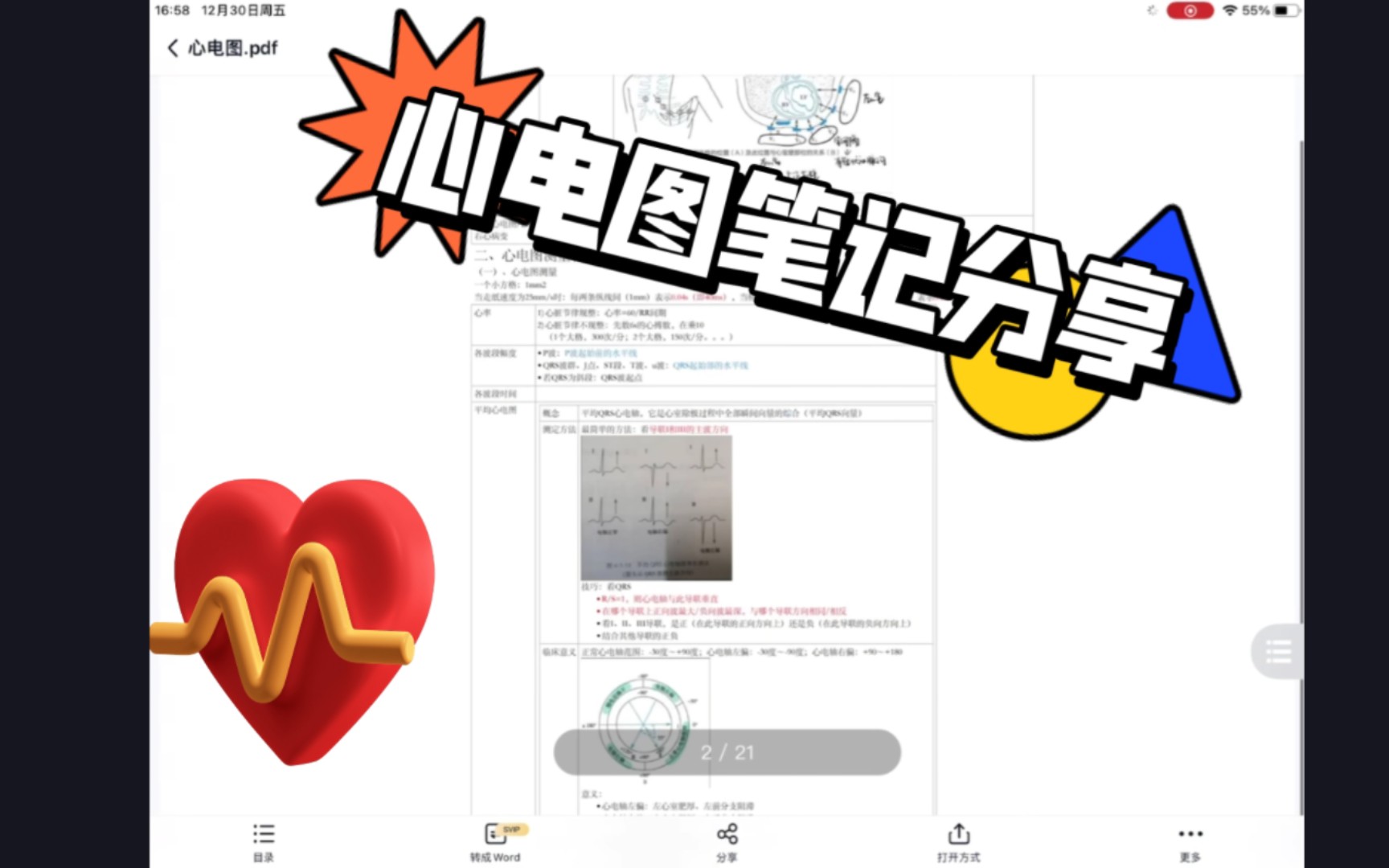 【心电图笔记分享】精心整理的心电图笔记来咯!笔记内容参考的是...