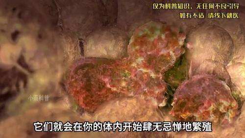 一分钟带你了解癌细胞是如何生长扩散的癌症又是什么原因产生的