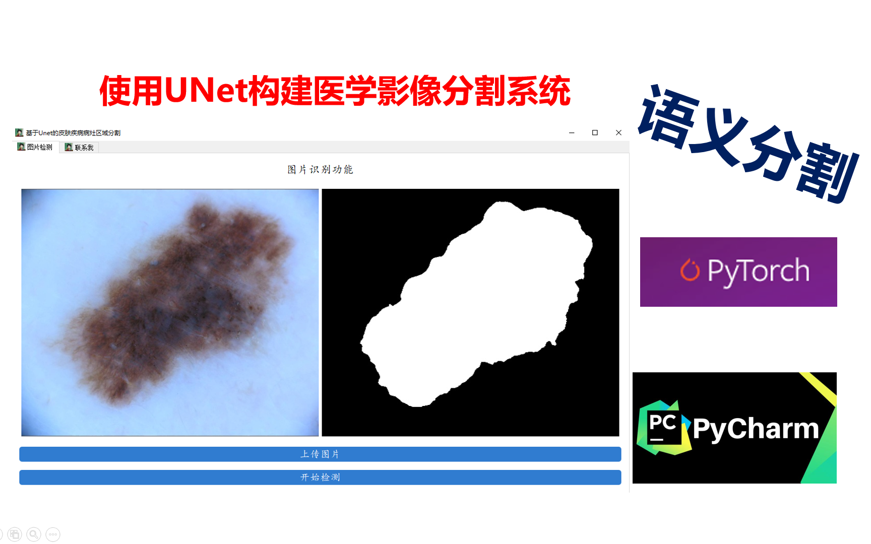 【大作业-07】手把手教你用UNet做医学图像分割系统