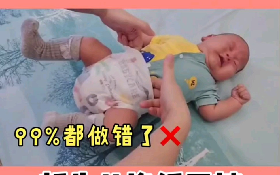 新生儿护理红屁屁