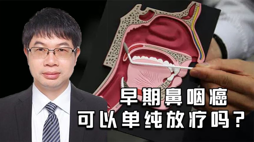 早期鼻咽癌患者,可以单独接受放疗吗?效果怎么样?