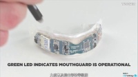 【触动力】可以避免脑残的智能牙套Prevent