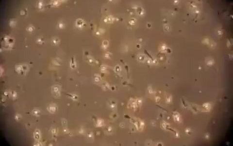 美国试管婴儿:#洗精术#是将单个精子从精液中分离出来的过程。