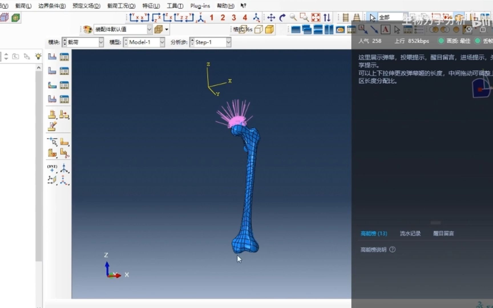 股骨骨折固定力学稳定性分析&骨科生物力学有限元分析课程学习视频#