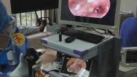视新医用高清电子支气管镜临床应用效果。
