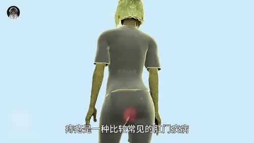 你知道痔疮是如何形成的吗?认真看完这期视频,或许你就明白了