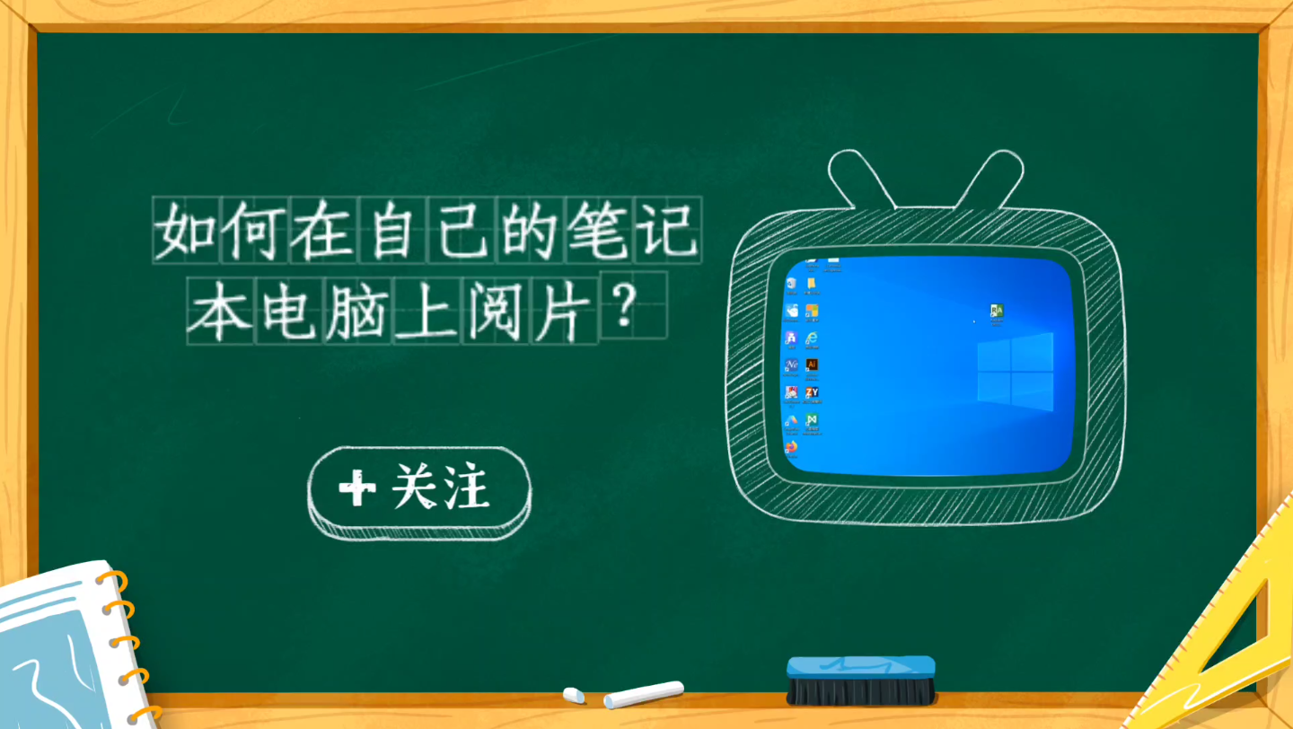 【阅片自由!RadiAnt】在自己的电脑上阅影像片!丝滑教程超简单!