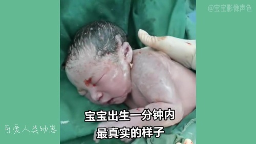 还以为刚出生的宝宝很漂亮,结果拉近镜头一看,吓了一跳