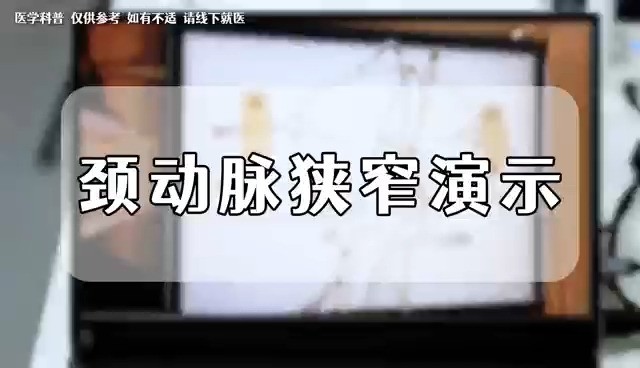 创导三维模型演示颈动脉狭窄