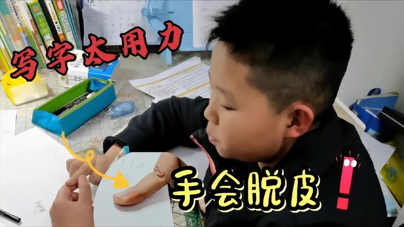小学生写字太用力导致手指脱皮,老爸:握笔姿势不对,谁说的对