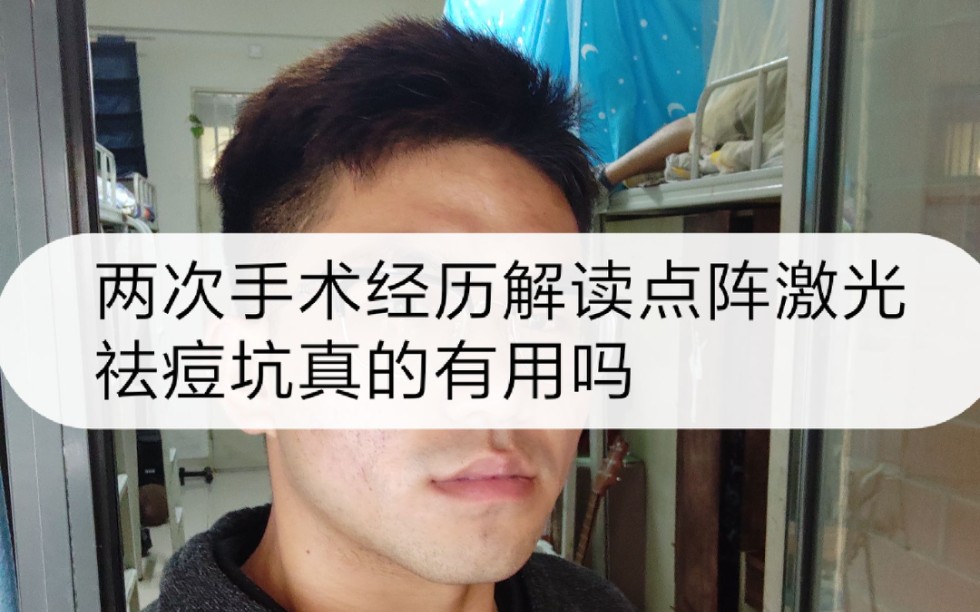 打完点阵激光后第七天恢复情况,两次手术经历解读点阵激光祛痘坑...