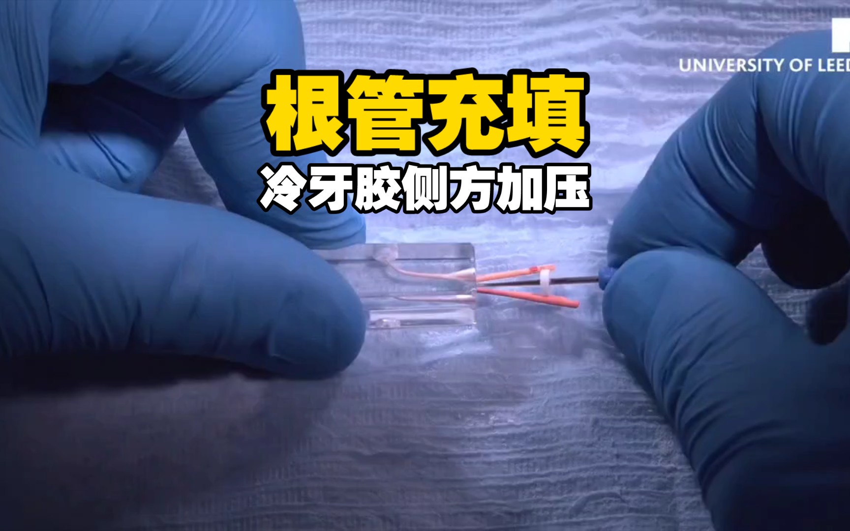根管充填,冷牙胶侧方加压