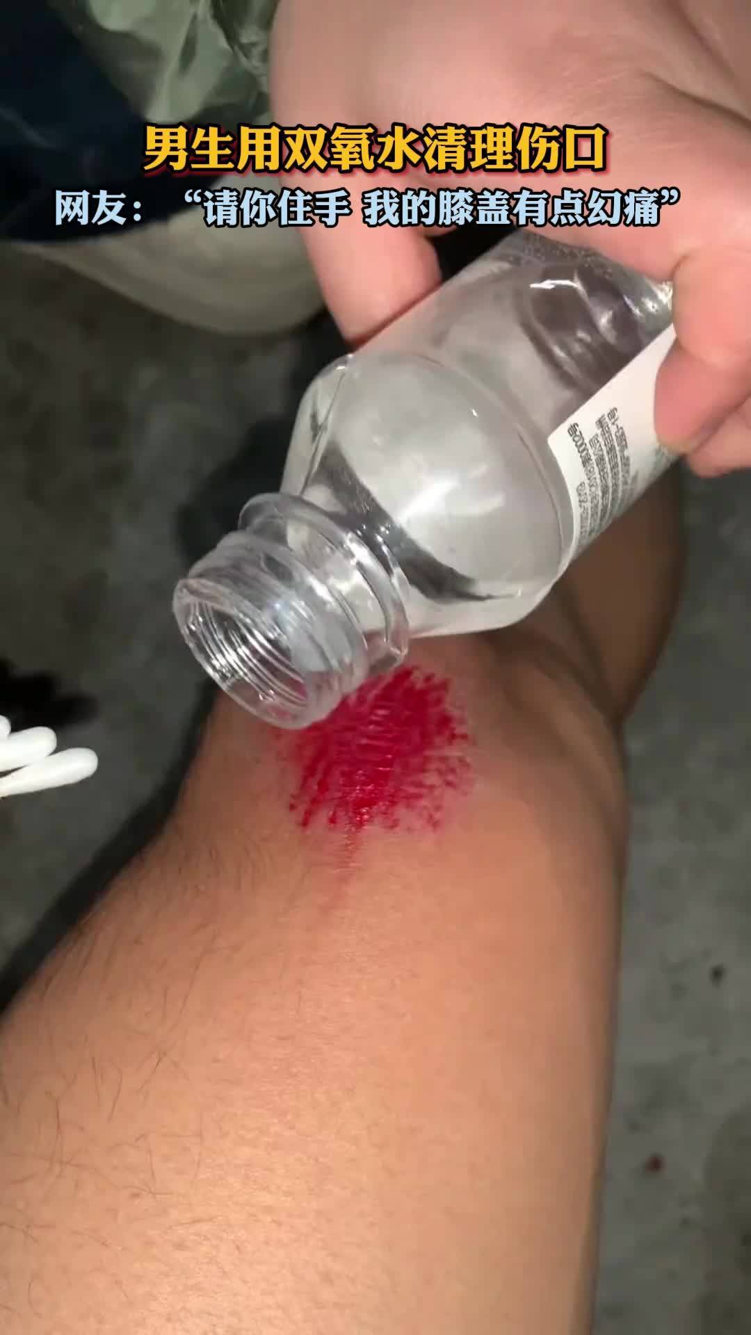 男生用双氧水清理伤口,网友:你给疼痛共享打开了?