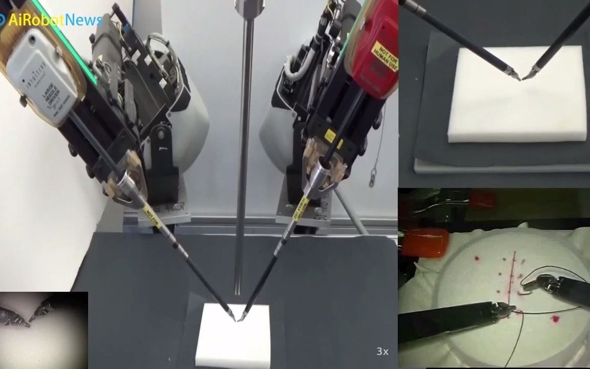 医疗机器人通过观看手术视频学习缝合