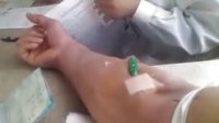 献血全过程《抽血》