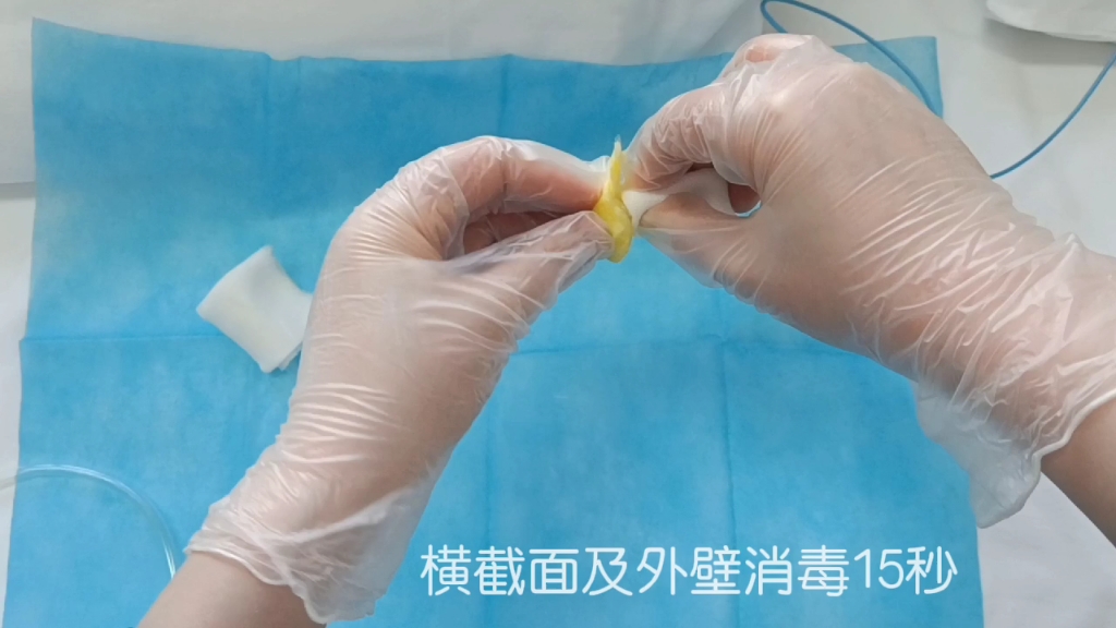 鼻胆管引流袋更换