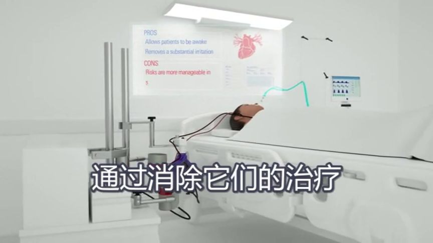 在治疗新型冠状病毒肺炎中 ECMO仪器工作动画视频