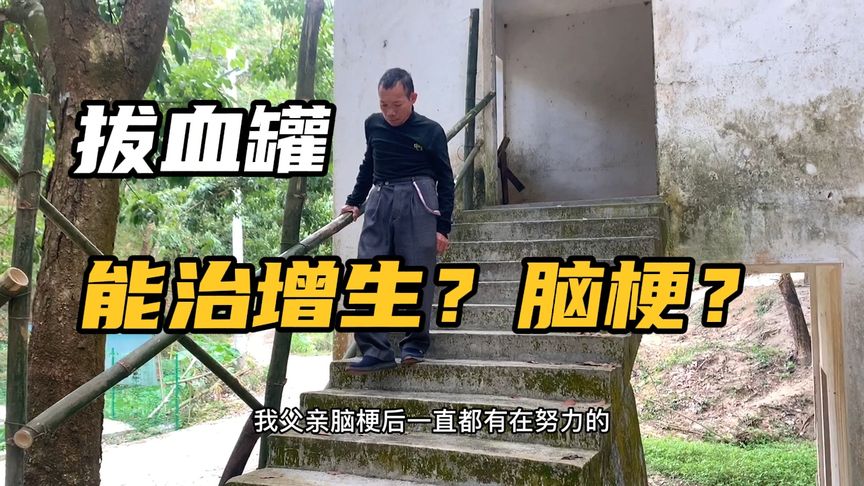 拔血罐真的能治疗增生、肩周炎、脑梗?真有这么神奇?