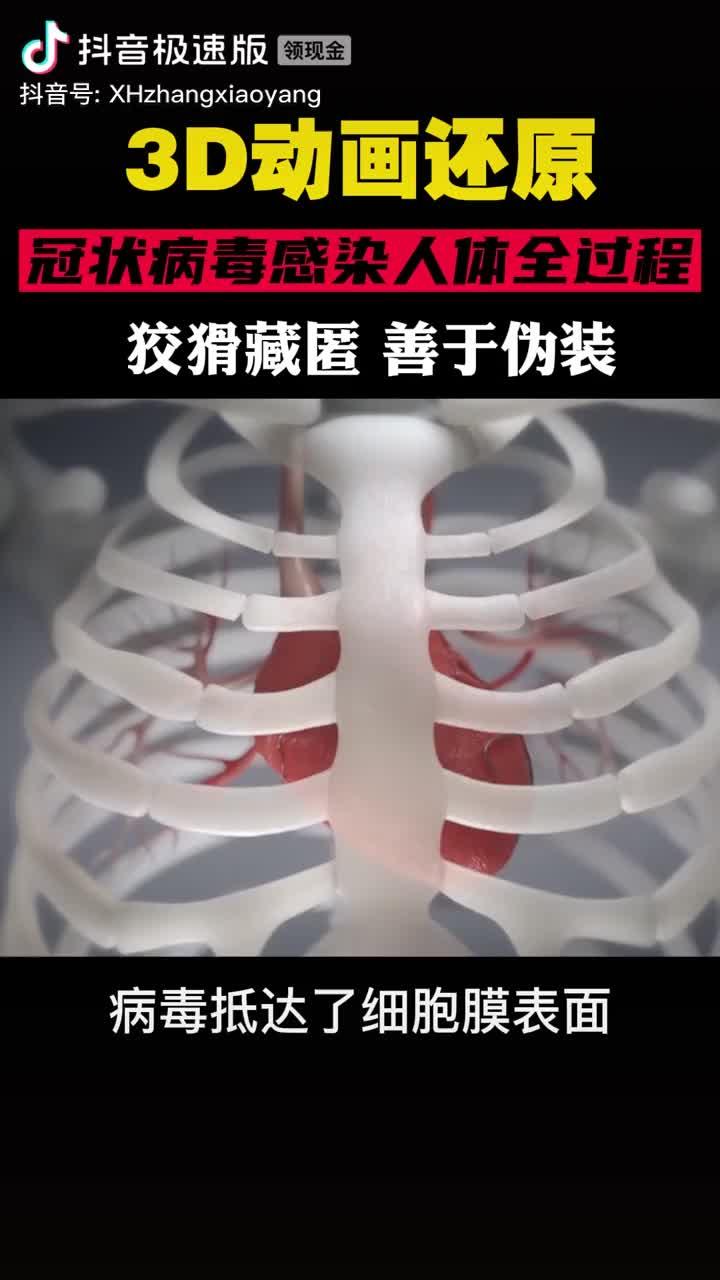 3D动画还原 冠状病毒感染人体全过程